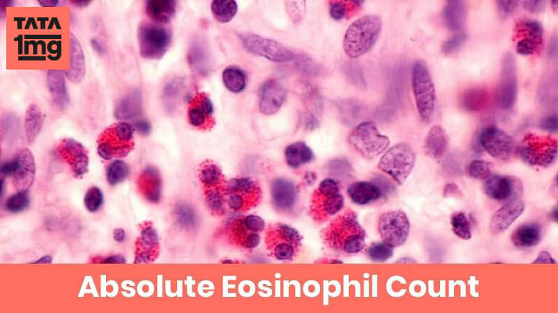 Absolute Eosinophil Count (AEC): Purpose & Normal Range of Results | 1mg