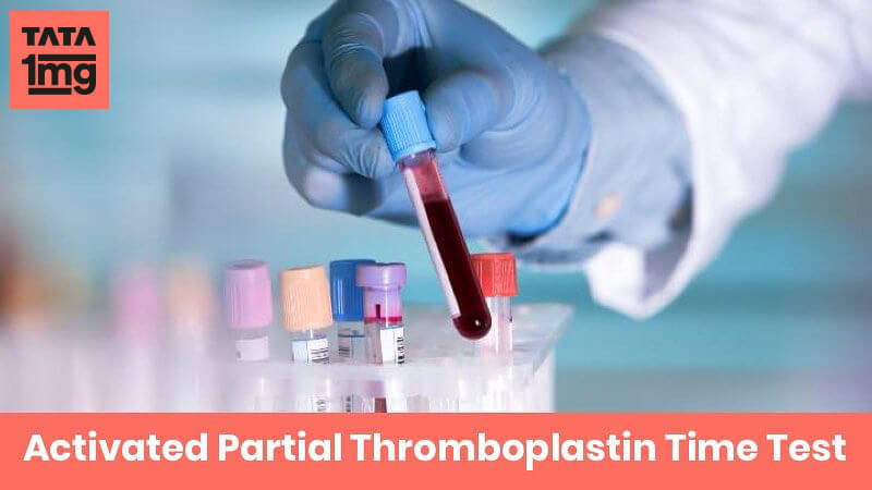 Activated Partial Thromboplastin Time (aPTT): Purpose & Normal Range of ...