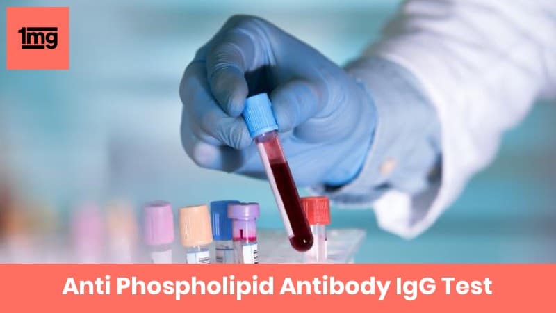 Anti Phospholipid Antibody IgG (APLA IgG, aPL IgG): Purpose & Normal ...