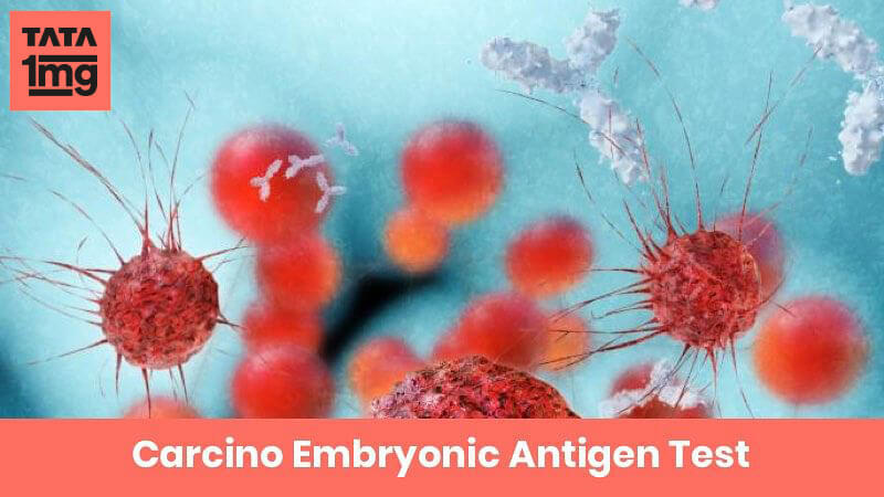 Carcino Embryonic Antigen (CEA): Purpose & Normal Range of Results | 1mg