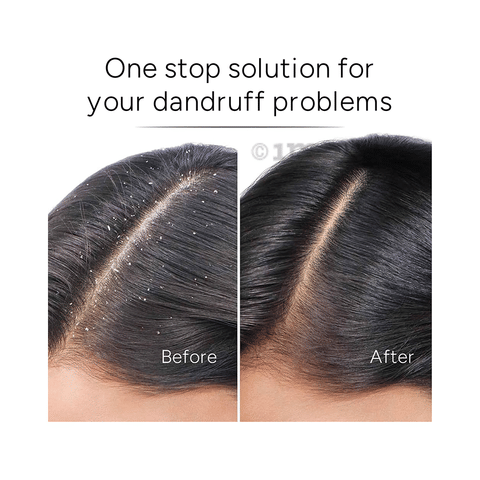 Buy Ketoconazole Anti Dandruff & Hair Care Shampoo | Helps Reduce ...